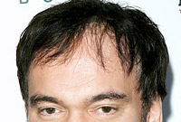 Balding? Don't do This, Gentlemen